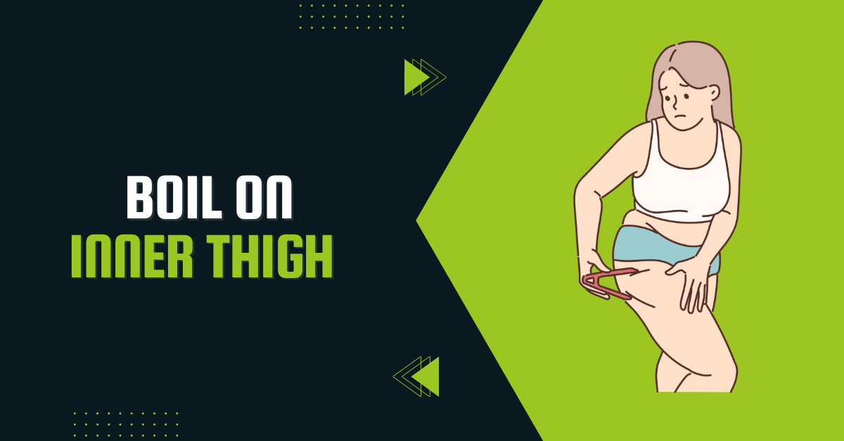 Boil On Inner Thigh: Symptoms, Causes, Treatment - Sustainable Food ...