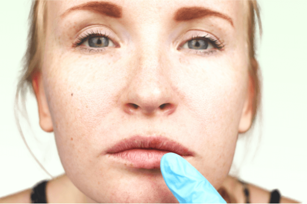 Pale Skin Around The Lips: Symptoms And Causes - Sustainable Food Trade ...